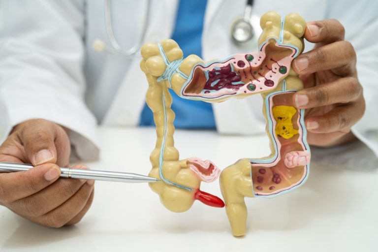 Do Dogs Have An Appendix? Vet-Verified Anatomy Explained – Dogster