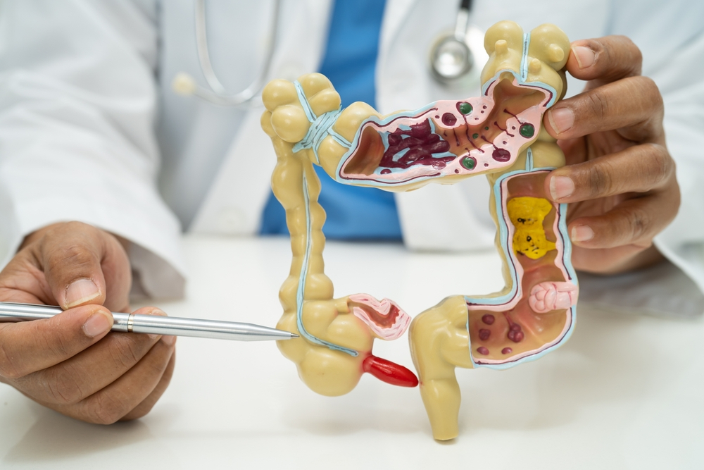 Do Dogs Have An Appendix? Vet-Verified Anatomy Explained – Dogster
